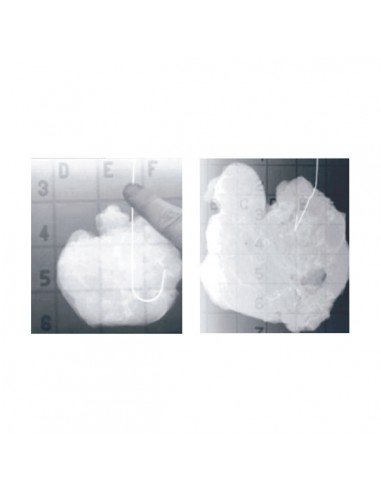 Transport grid for breast tissu specimen transport un surgery